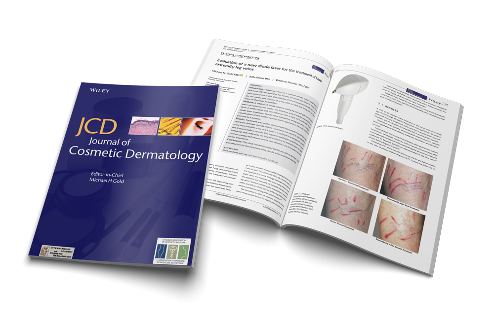 Clinical Study on Vasculaze Laser for Leg Veins