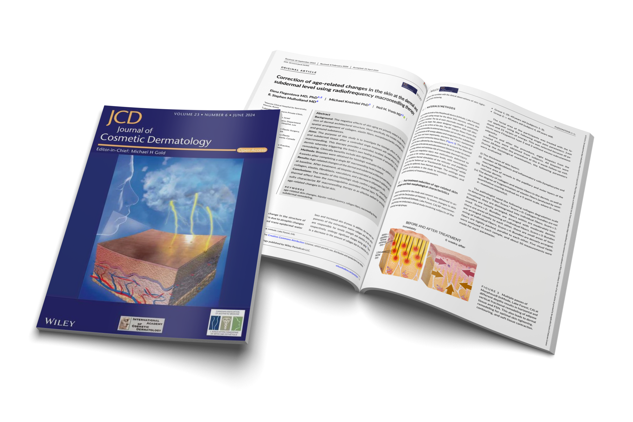 Clinical Paper: Fractora RF for Fractional Resurfacing