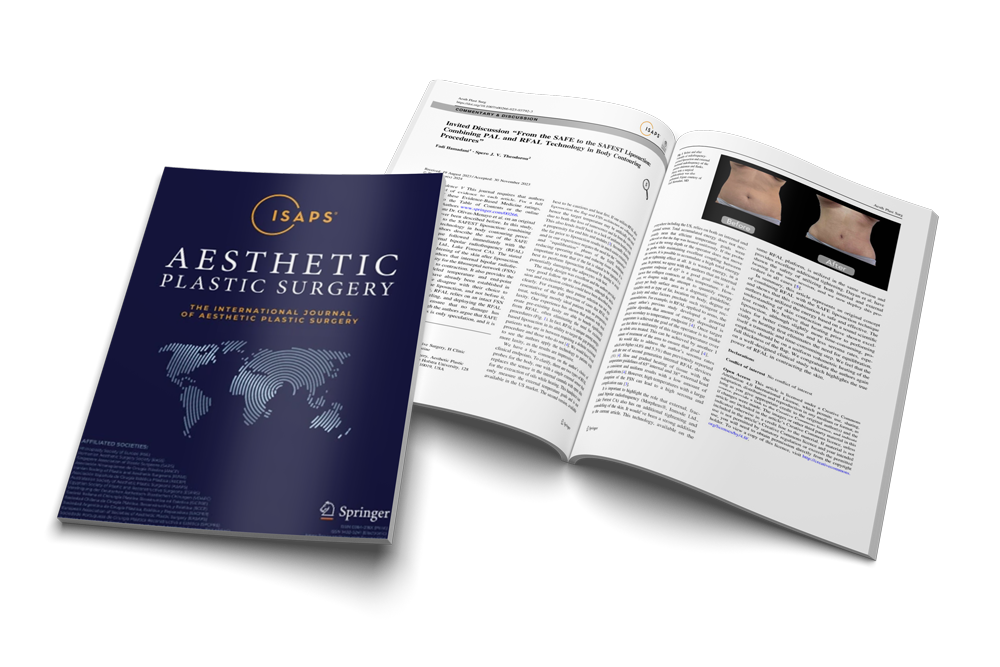 Study: BodyTite RFAL for Cellulite Reduction