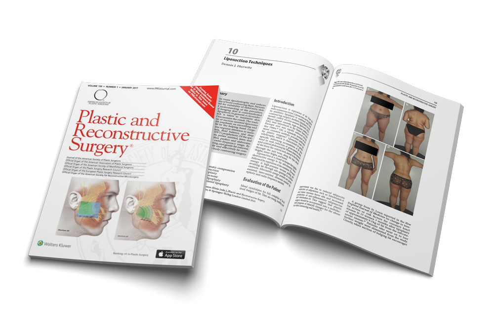 Study: BodyTite RFAL for Cellulite Reduction