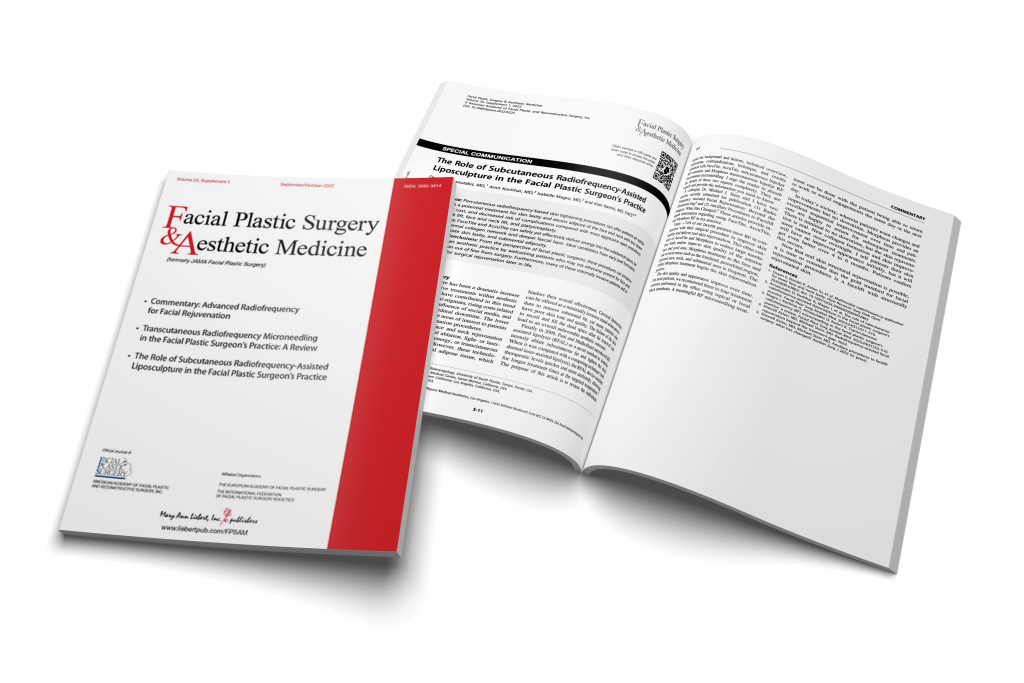 Study: Face Expressive Lifting (FEL) Technique with FaceTite RF