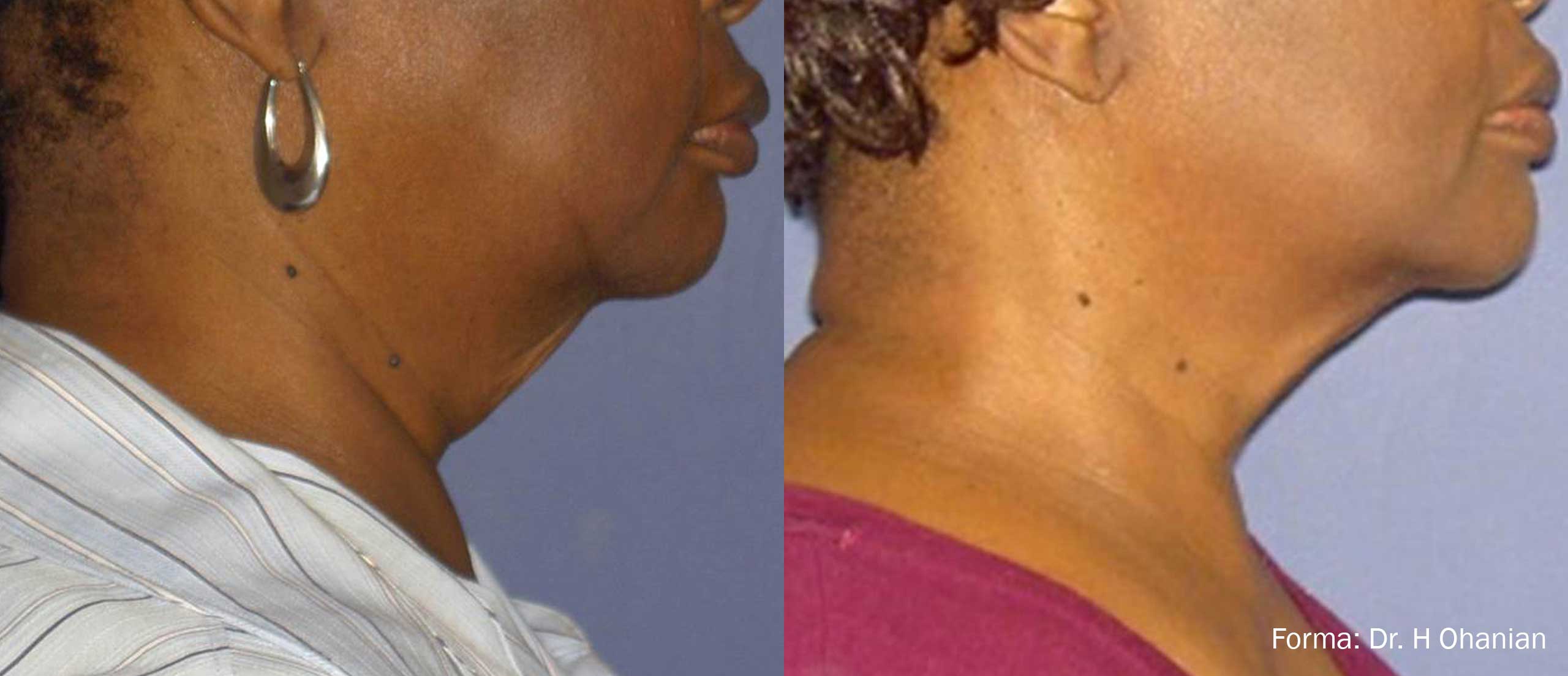 Forma & Plus by InMode | Professional Resources & Training