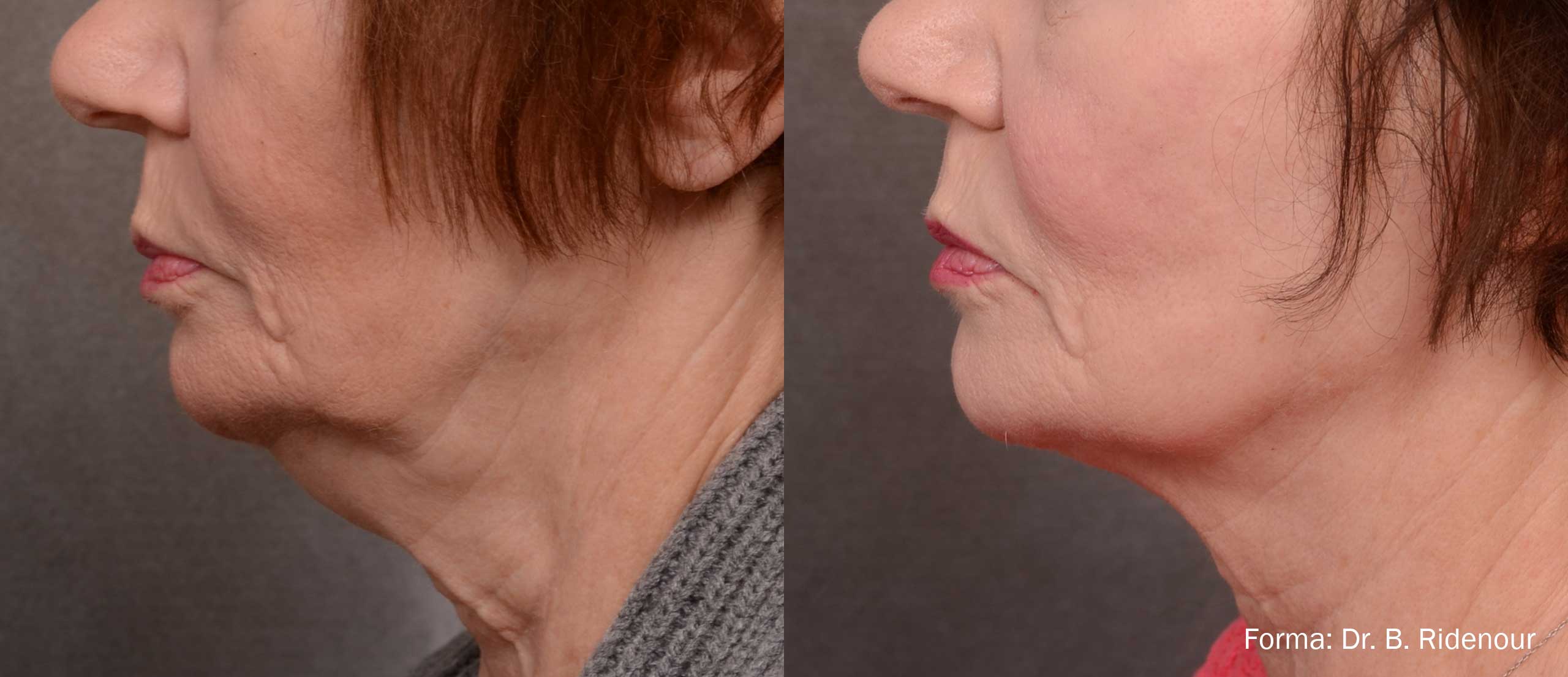 Forma & Plus by InMode | Professional Resources & Training