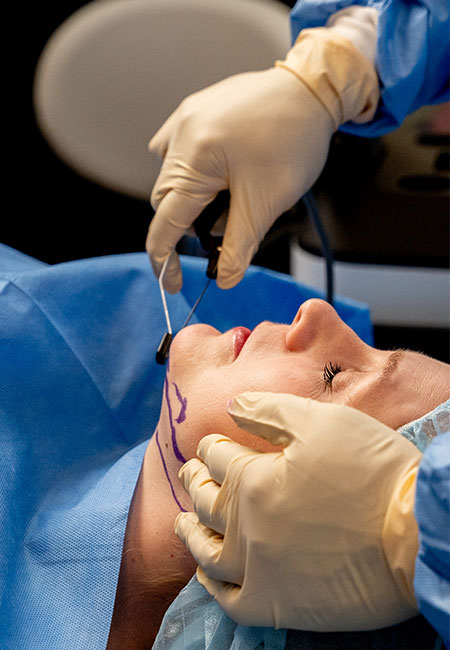 AccuTite RFAL Educational Resources | InMode University